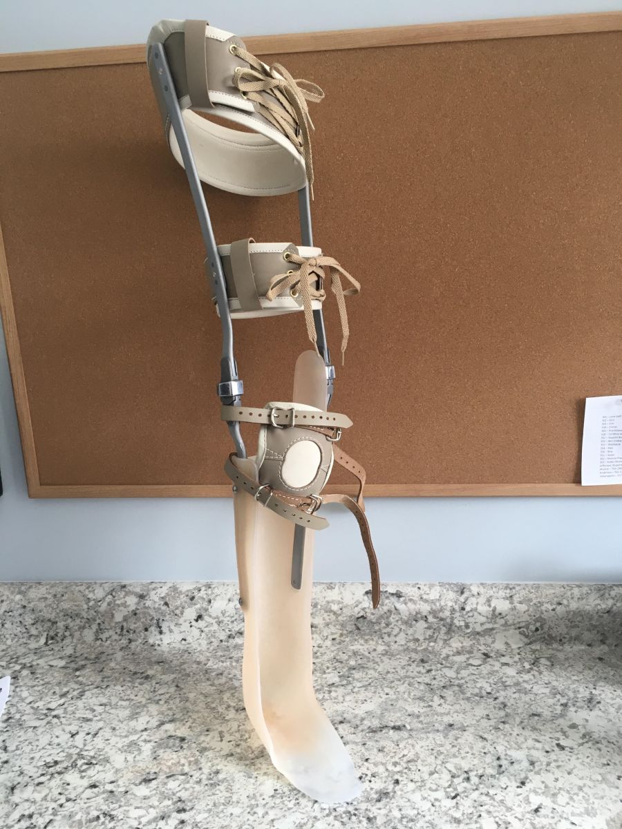 In House Fabrication - Prevail Prosthetics & Orthotics | Indiana