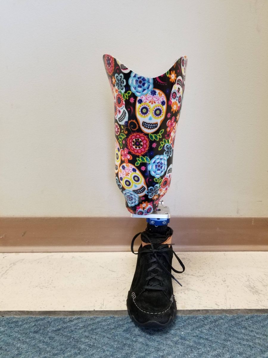 : In House Fabrication - Prevail Prosthetics & Orthotics | Indiana