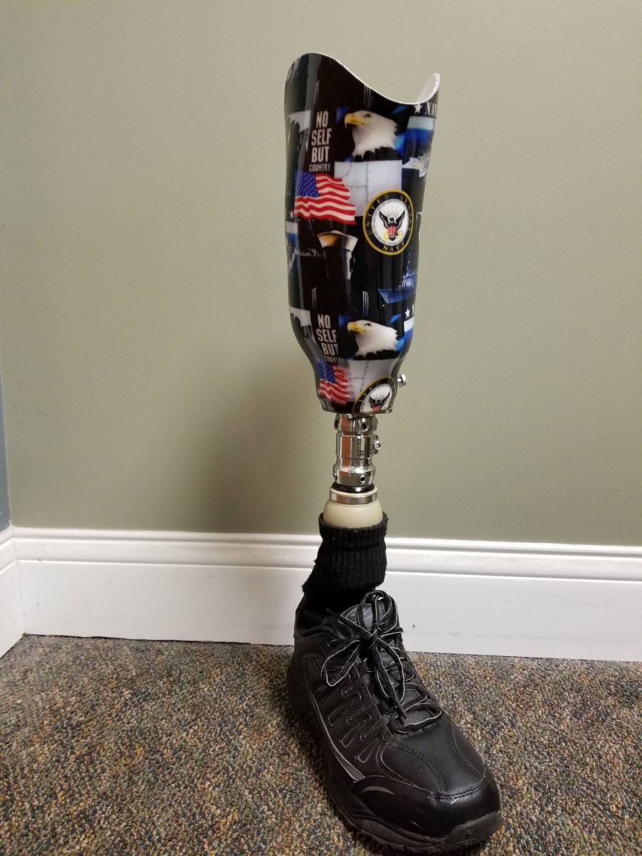 In House Fabrication - Prevail Prosthetics & Orthotics | Indiana