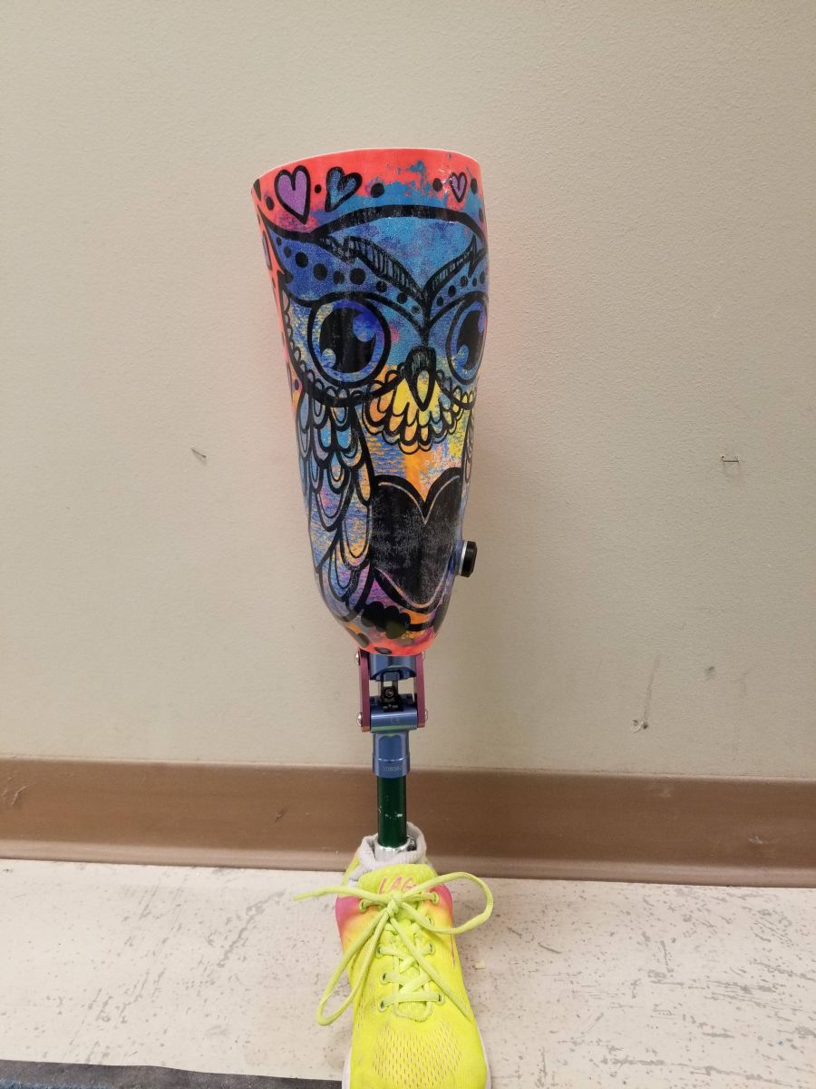 : In House Fabrication - Prevail Prosthetics & Orthotics | Indiana