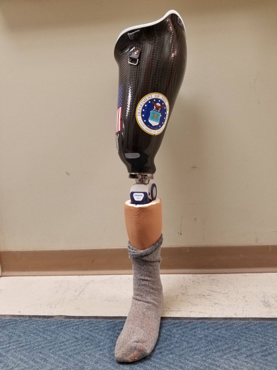 In House Fabrication - Prevail Prosthetics & Orthotics | Indiana